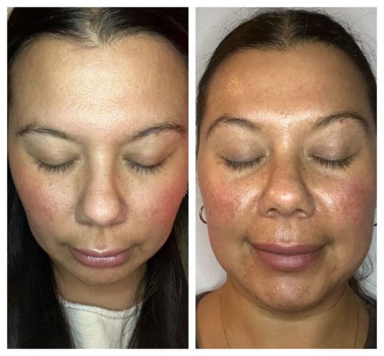 We Tried 5 Lash Serums And These Were Our Results - Living in Yellow