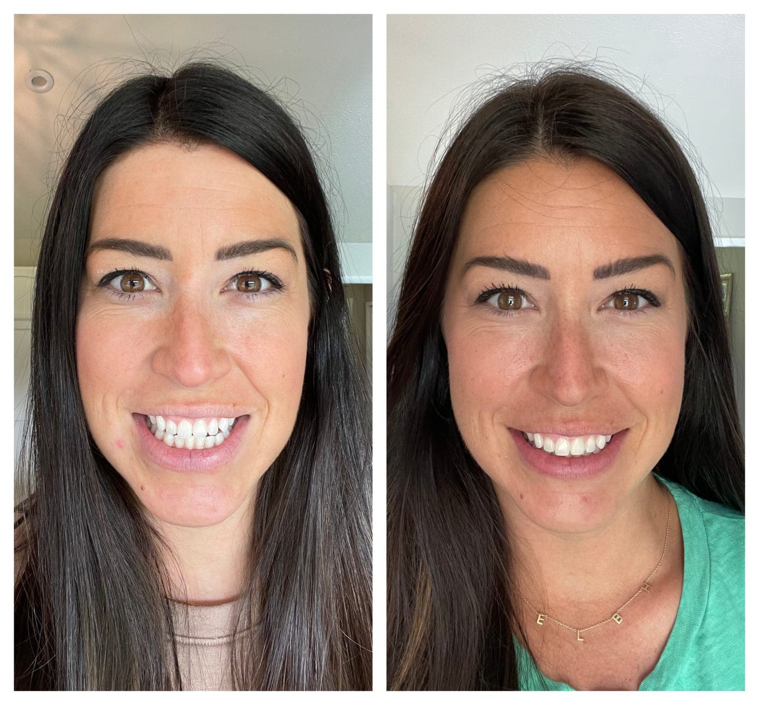 We Tried 5 Popular Teeth Whiteners - Living in Yellow