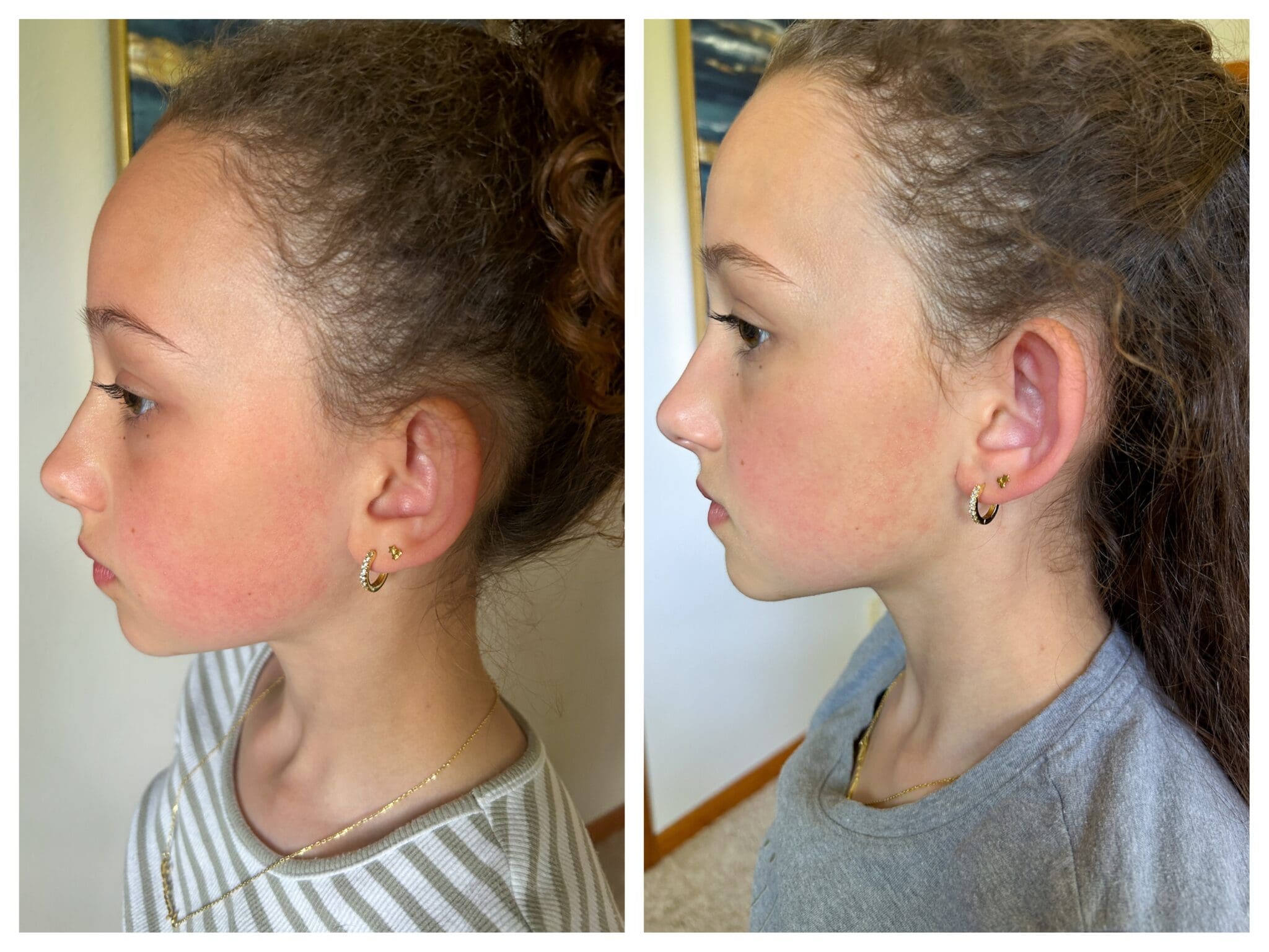 What You Should Know About Trying Beef Tallow - Living in Yellow